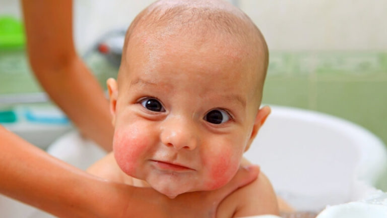 The Baby Orange Nose Scare And Why You Should Not Worry